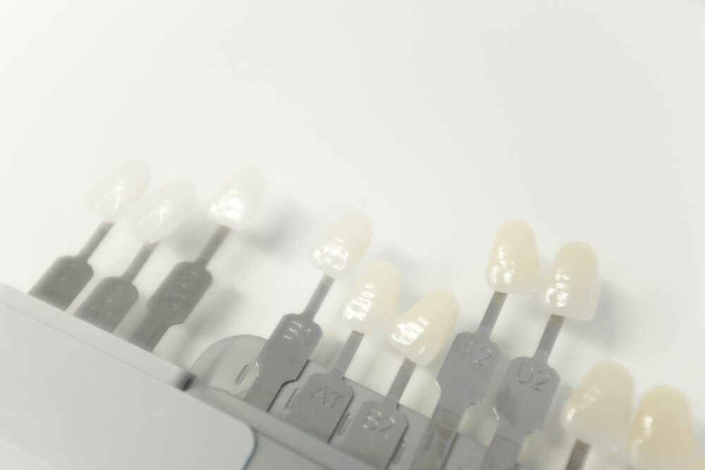 Zahnbleaching mit der ZOOM! Methode von Philips - Alexandra Winzer